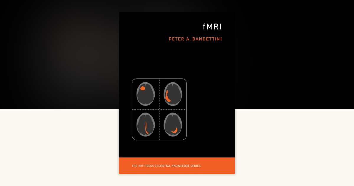 fMRI by Peter A. Bandettini: 9780262538039 | PenguinRandomHouse.com: Books